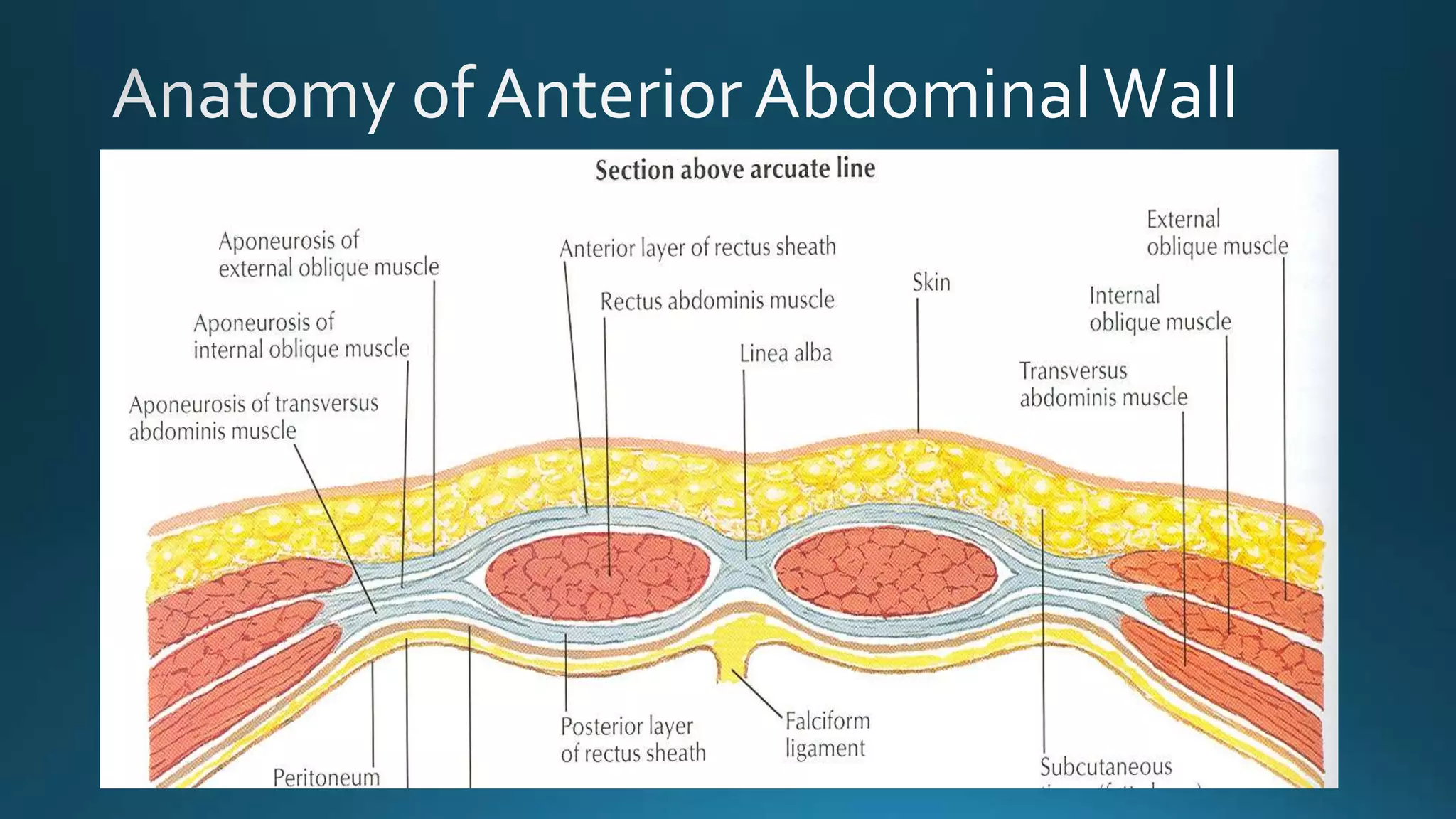 Laparoscopic repair of hernia- A Guide to Laparoscopic Hernia Surgery ...