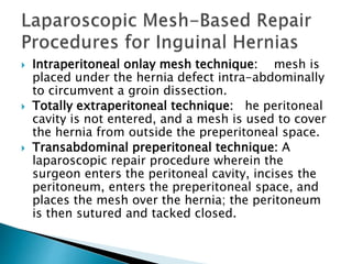 Laparoscopic repair of inguinal hernia | PPTX