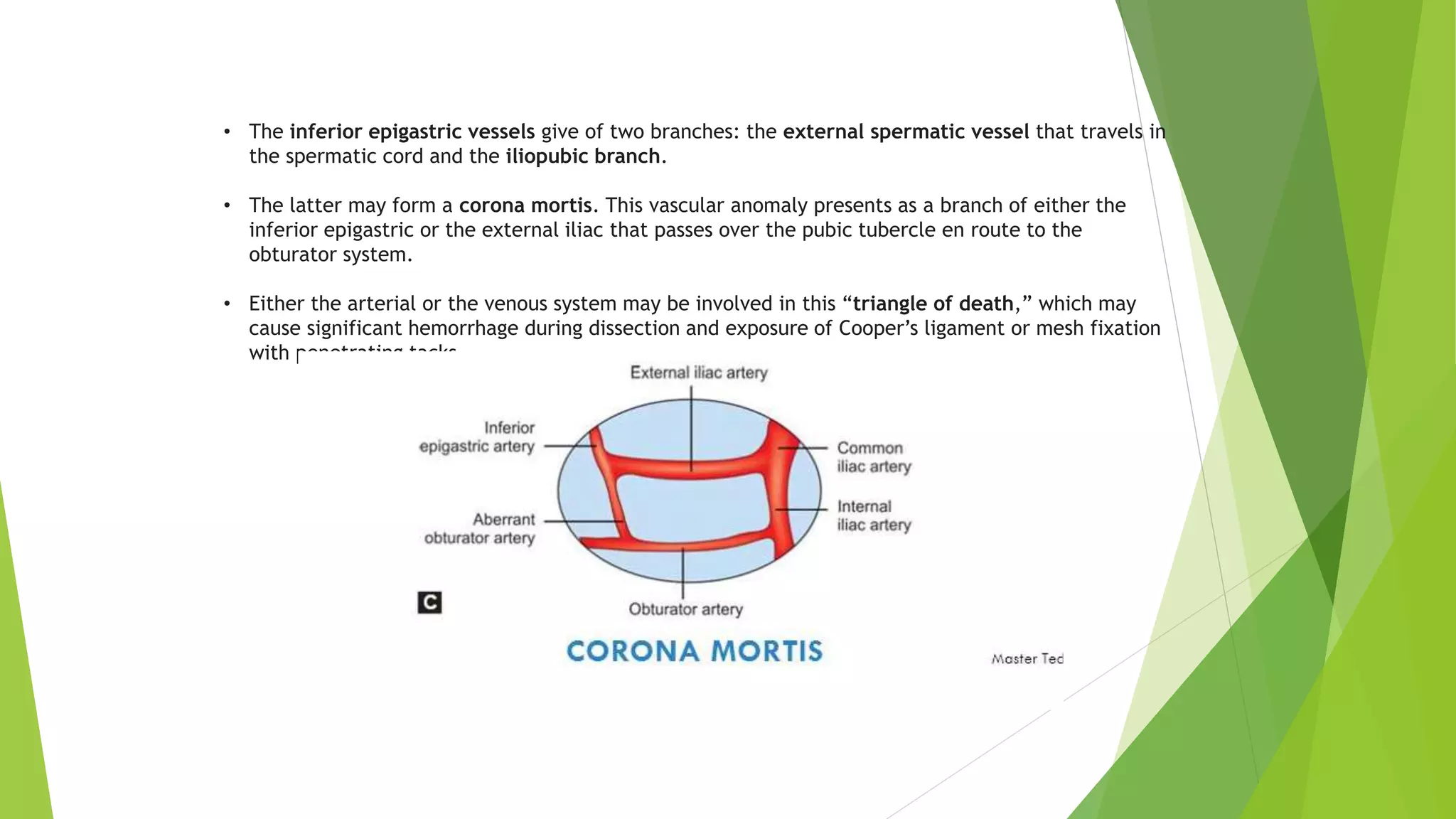 Laparoscopic retroperitoneal triple neurectomy | PPTX | Bone and Joint ...