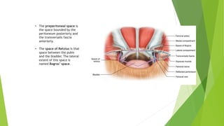 Laparoscopic retroperitoneal triple neurectomy | PPTX