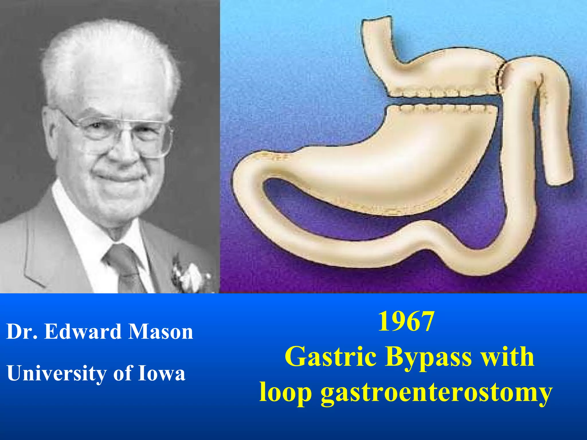 Laparoscopic Roux En-Y-Gastric Bypass: One Surgeon's Technique | PPT