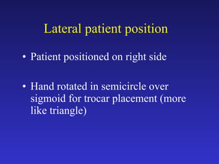 Laparoscopic Sigmoid Colon Resection for Diverticular Disease | PPT