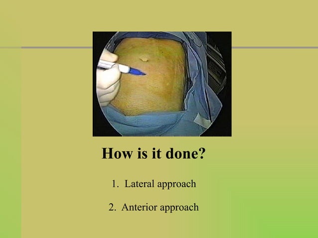 Laparoscopic Sigmoid Colon Resection: Supine and Lateral | PPT | Death ...