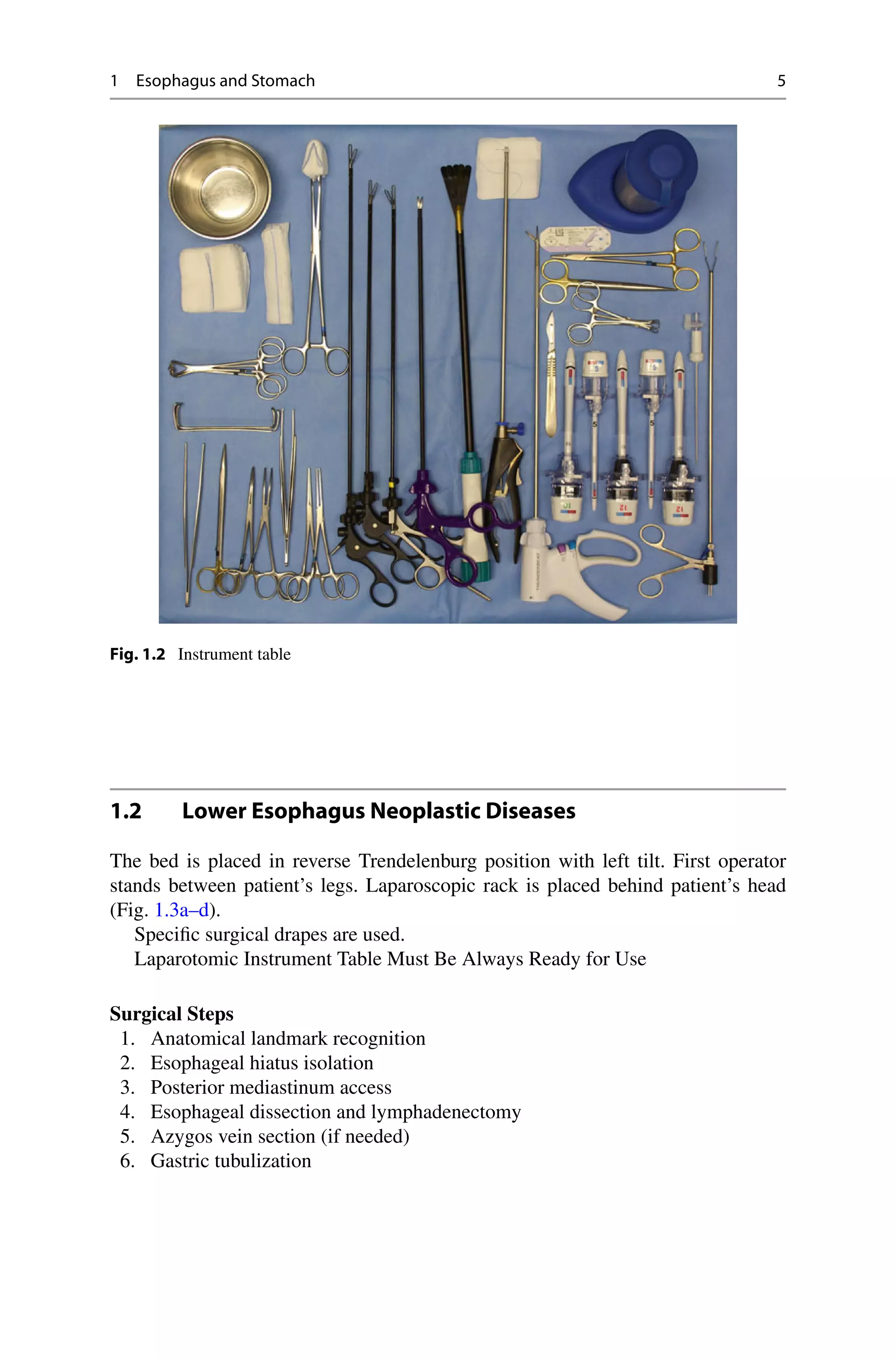 Laparoscopic surgery | PDF