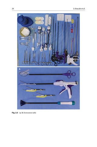 Laparoscopic surgery | PDF