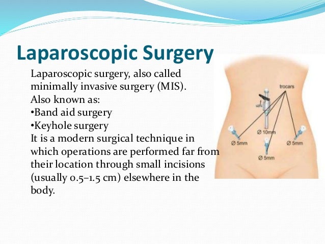Laparoscopic Surgery in Chandigarh