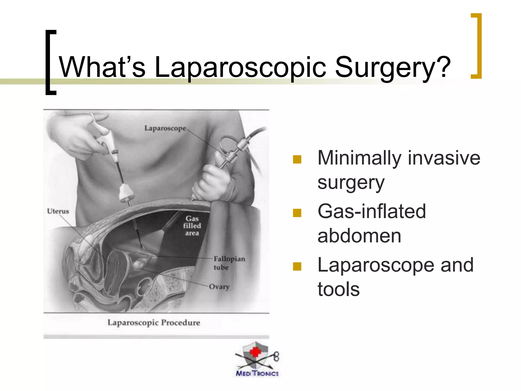 Laparoscopic Surgery Training System.ppt