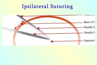 Laparoscopic Suturing And Knotting Mob: 7289915430, www.drpradeepgarg | PPT