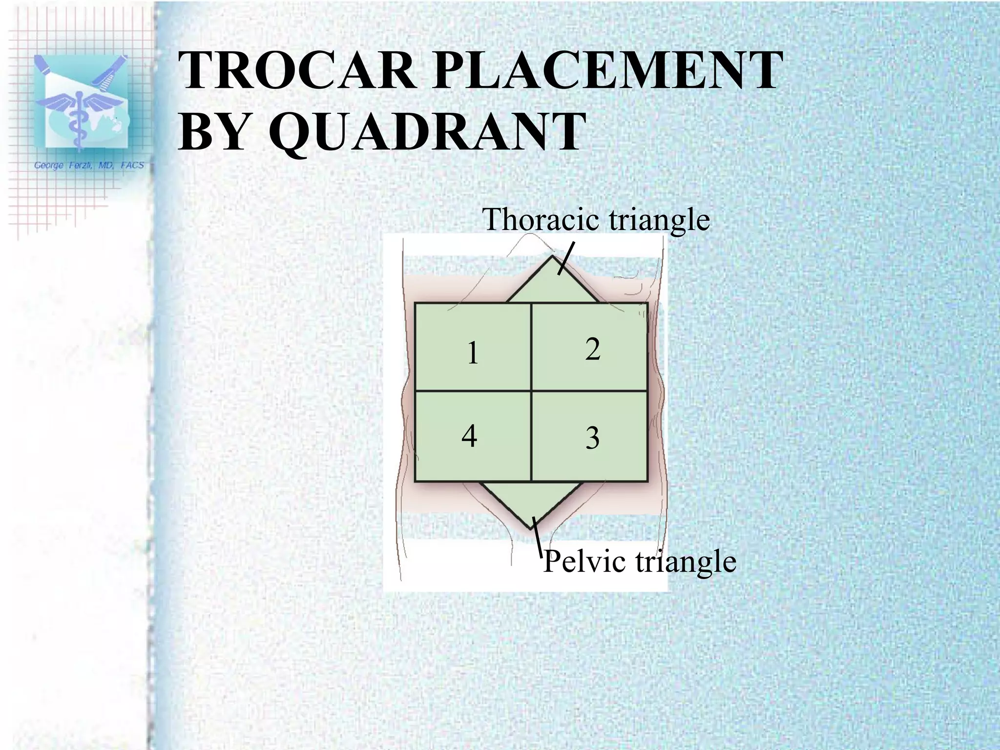 Laparoscopic Trocar Placement | PPT