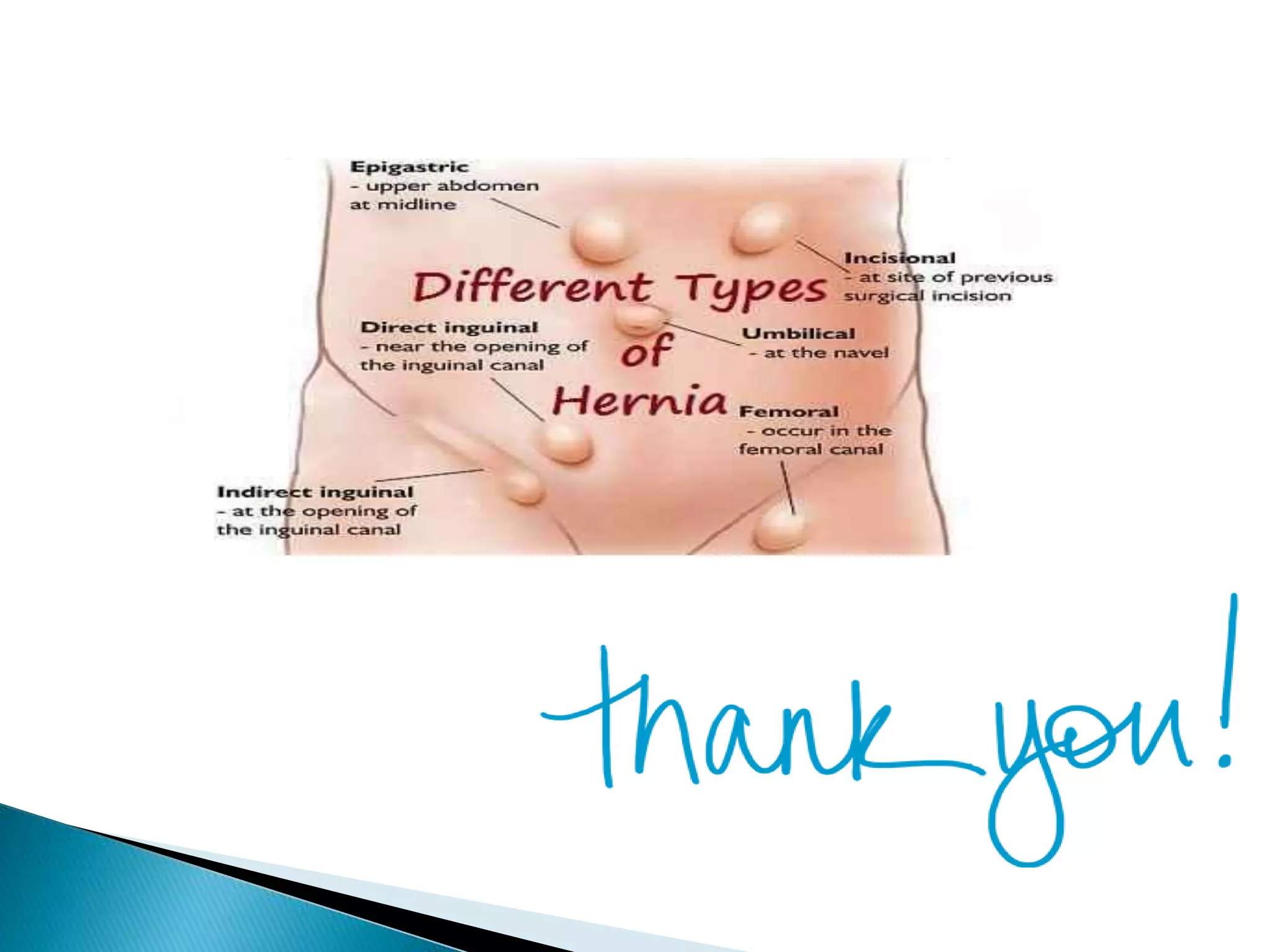 Laparoscopic umbilical hernia repair | PPTX