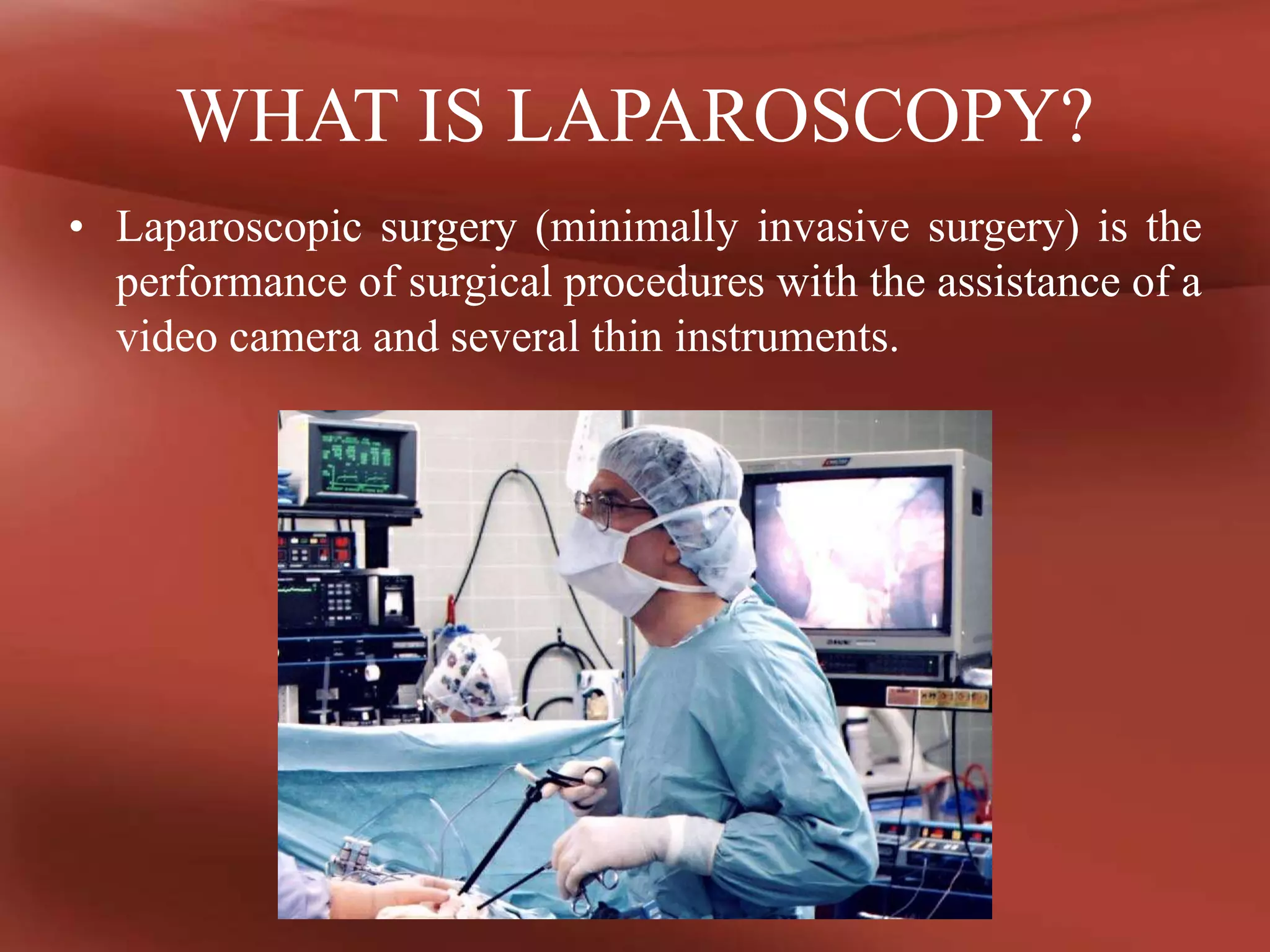 Laparoscopy | PPTX