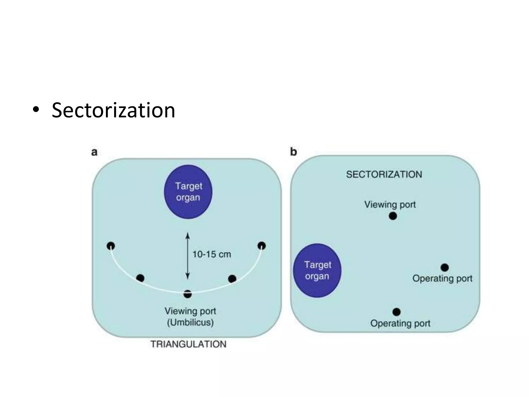 Basic of Laparoscopy | PPTX