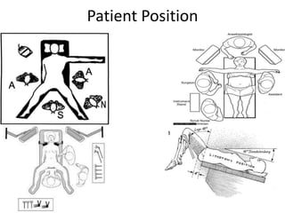 Basic of Laparoscopy | PPTX