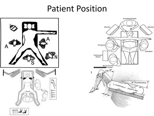 Basic of Laparoscopy | PPTX