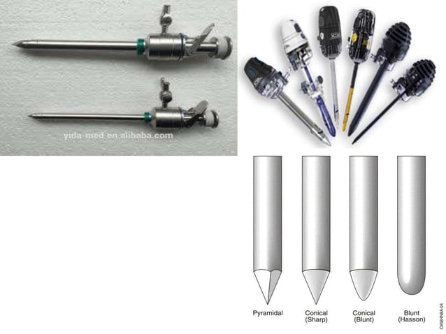 Basic of Laparoscopy | PPTX