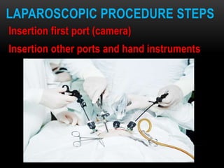 Laparoscopy | PPTX
