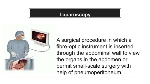 Laparoscopy | PPTX