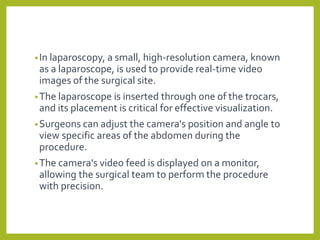LAPAROSCOPY.pptx