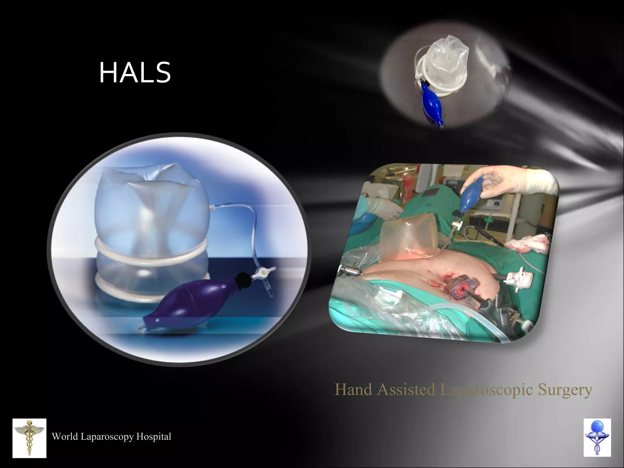 Introduction of Laparoscopic Surgery | PPT