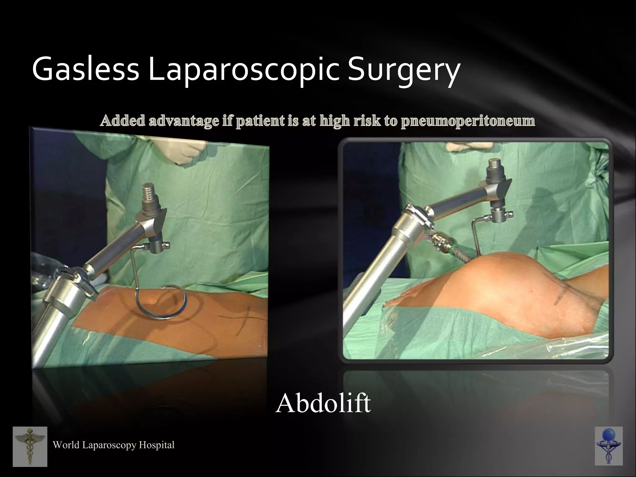 Introduction of Laparoscopic Surgery | PPT