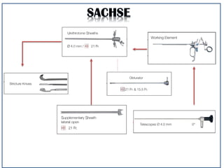 Laparoscopy - Sachse (5 Agustus 2021) (1).pdf
