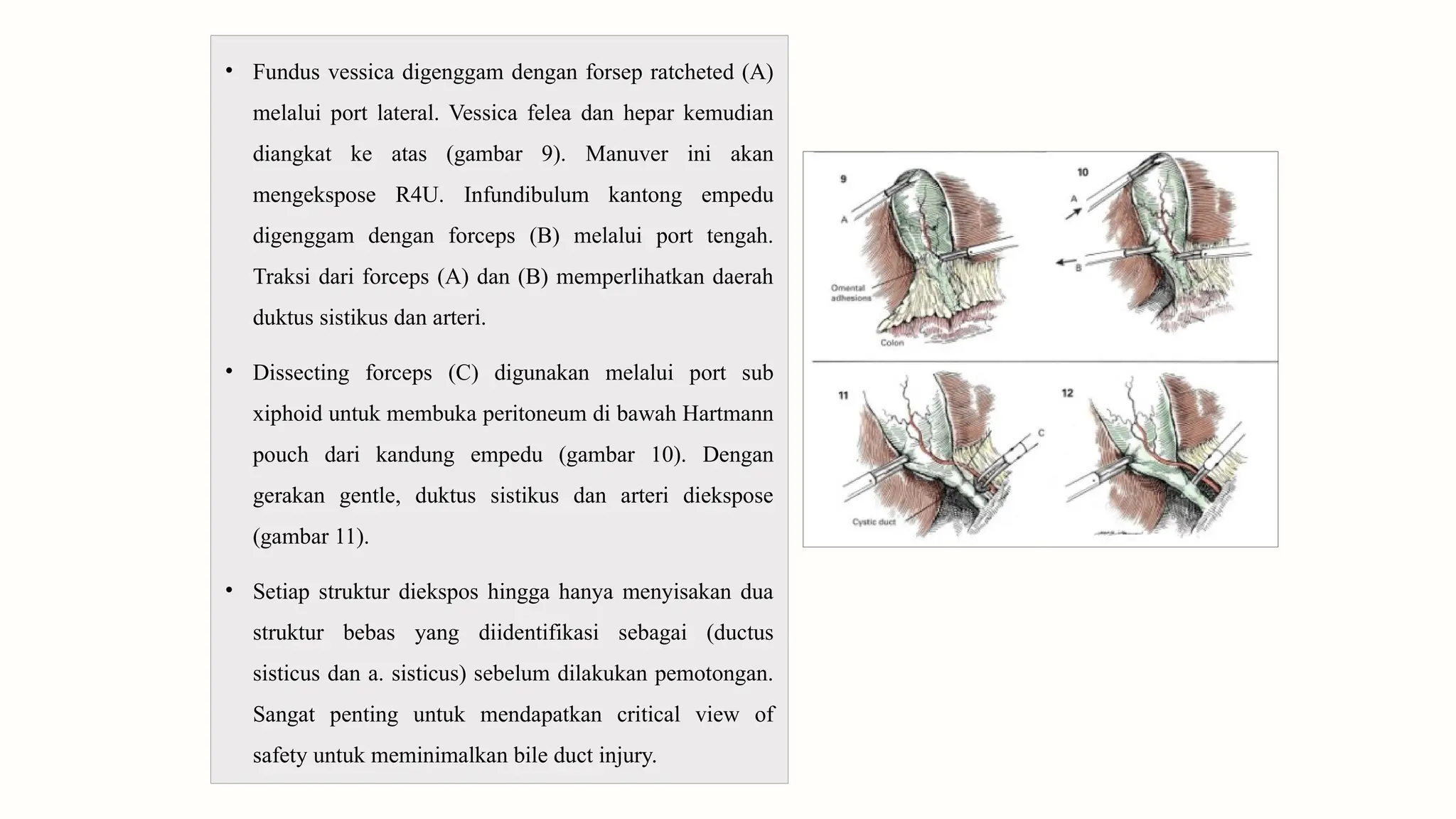 Laparoscopy cholesistektomi OPTEKKKK PPT | PPTX