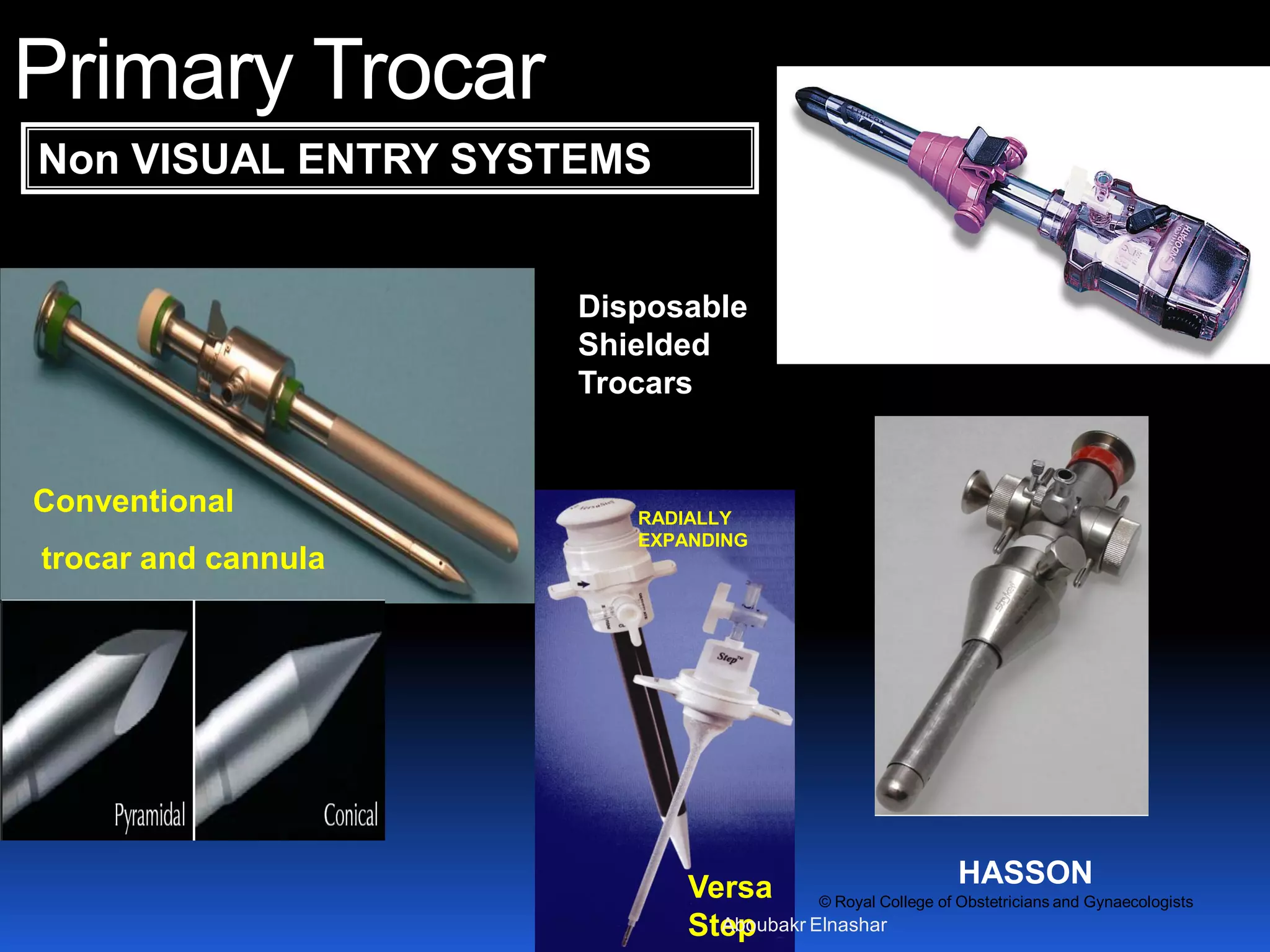 LAPAROSCOPIC ENTRY | PDF