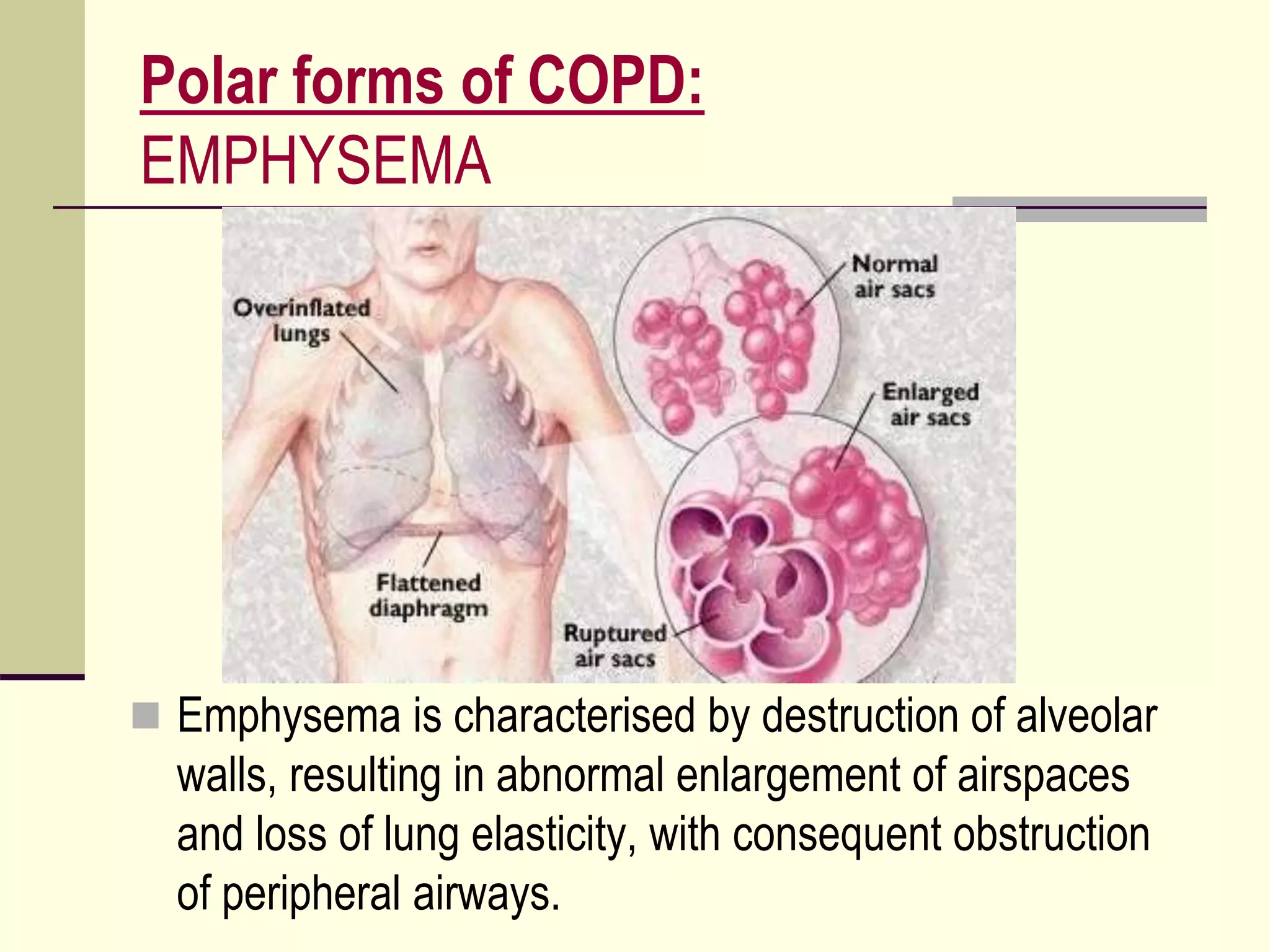 Laparoscopy in COPD: Anaesthesia | PPTX