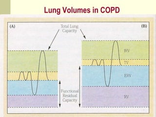 Laparoscopy in COPD: Anaesthesia | PPTX