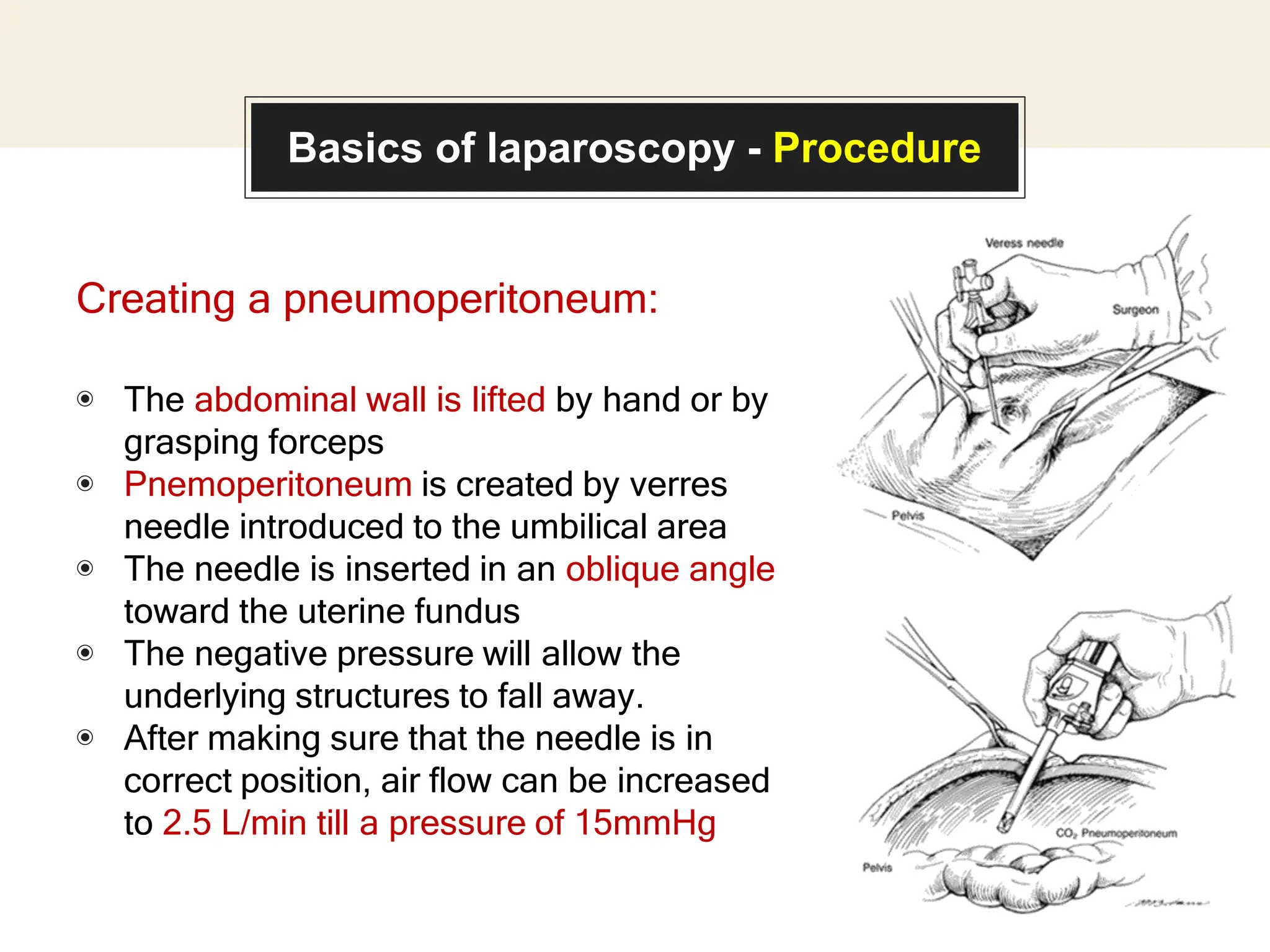 laparoscopy in gynaecology nursing students | PPTX