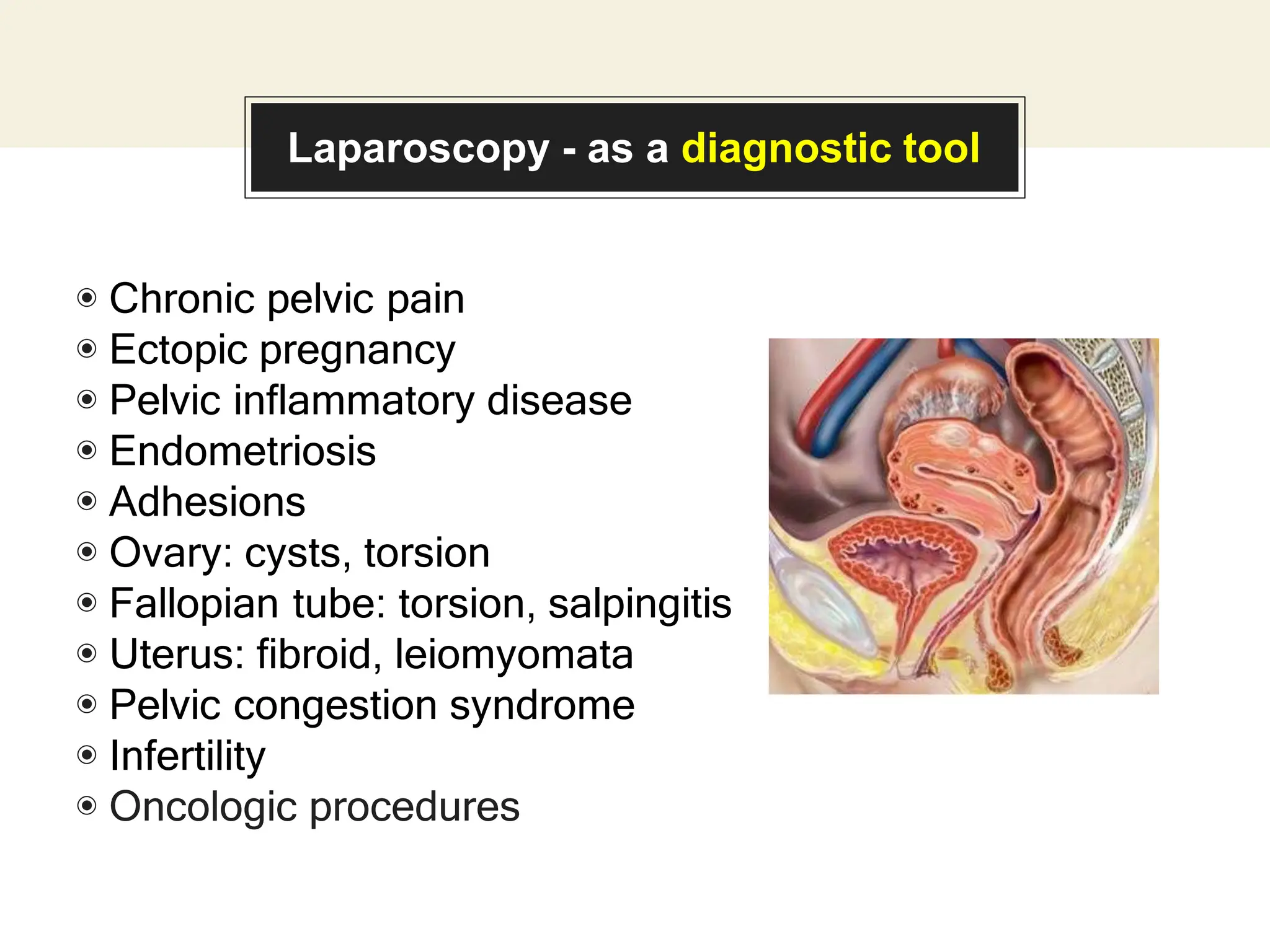 laparoscopy in gynaecology nursing students | PPTX