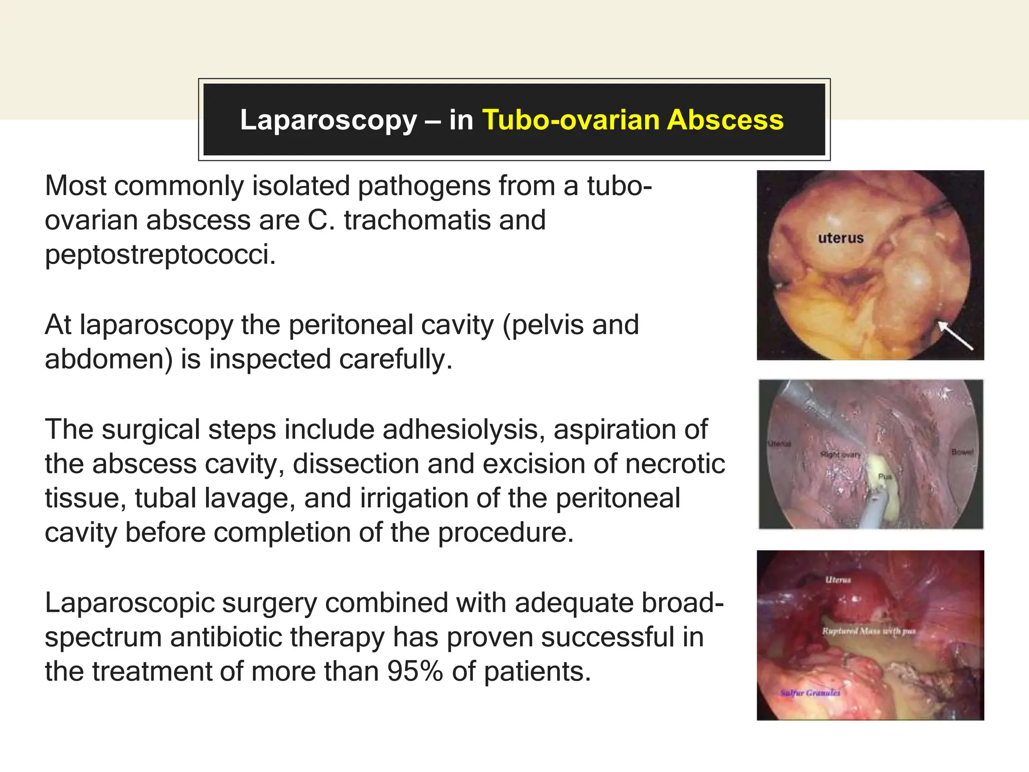 laparoscopy in gynaecology nursing students | PPTX