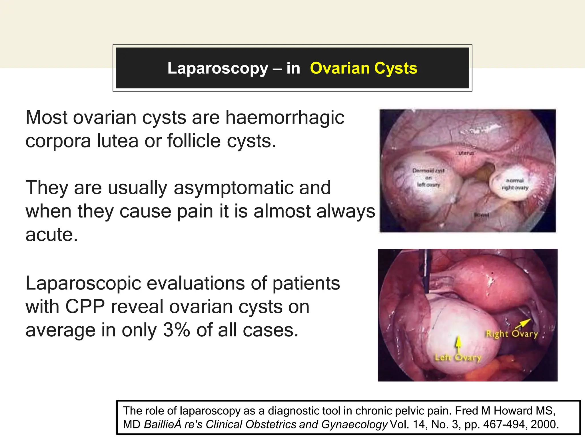 laparoscopy in gynaecology nursing students | PPTX