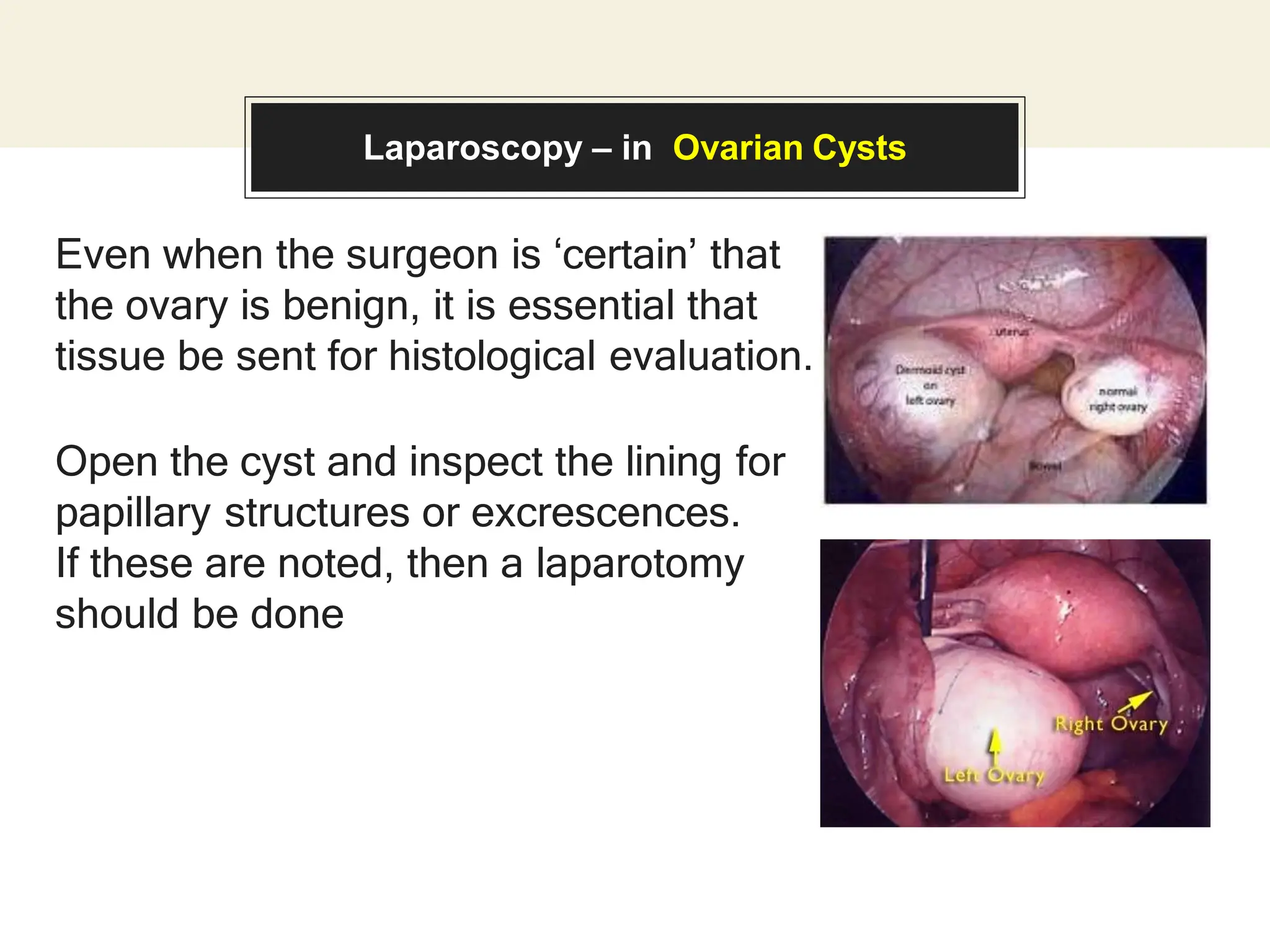 laparoscopy in gynaecology nursing students | PPTX