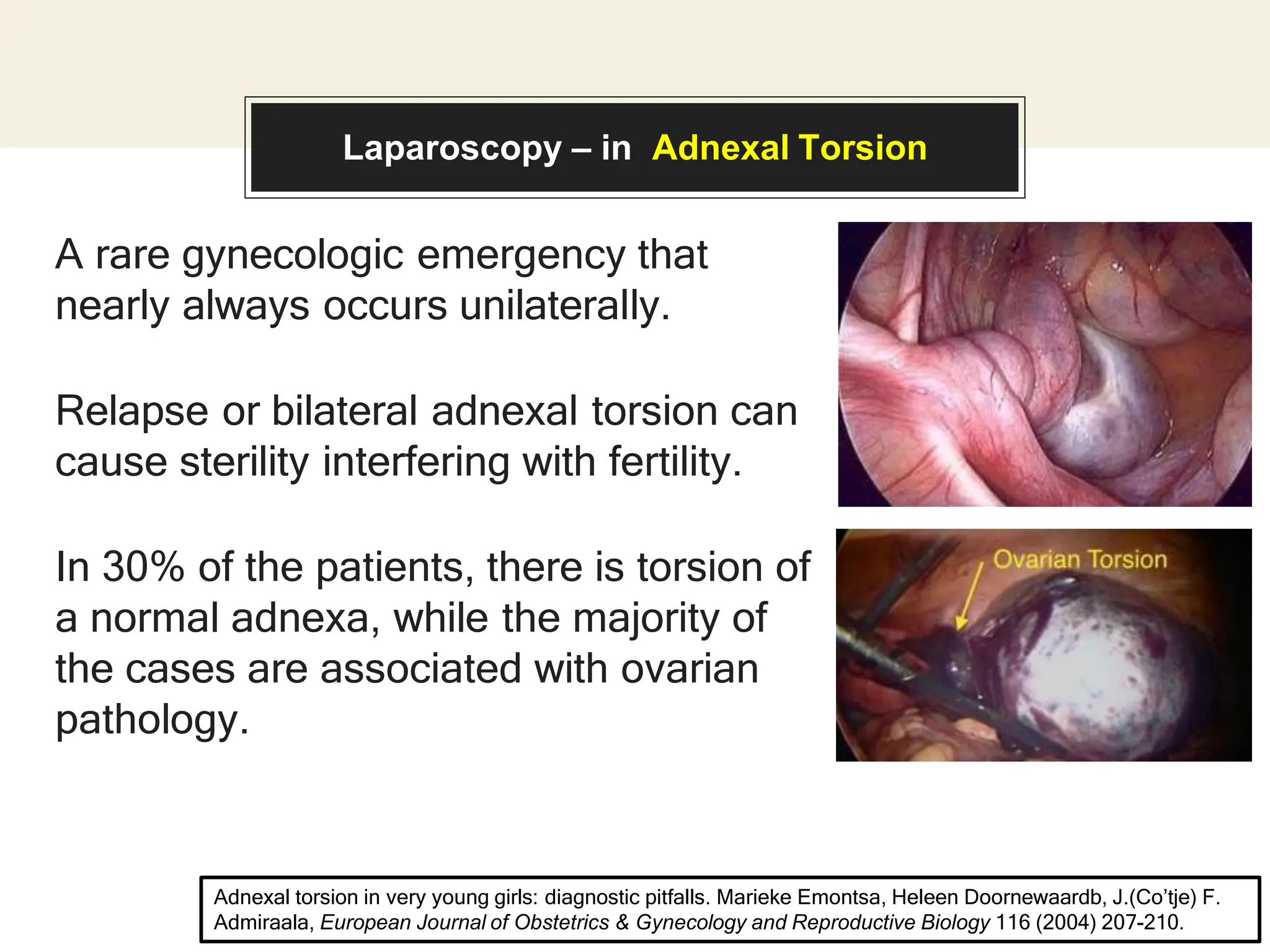laparoscopy in gynaecology nursing students | PPTX