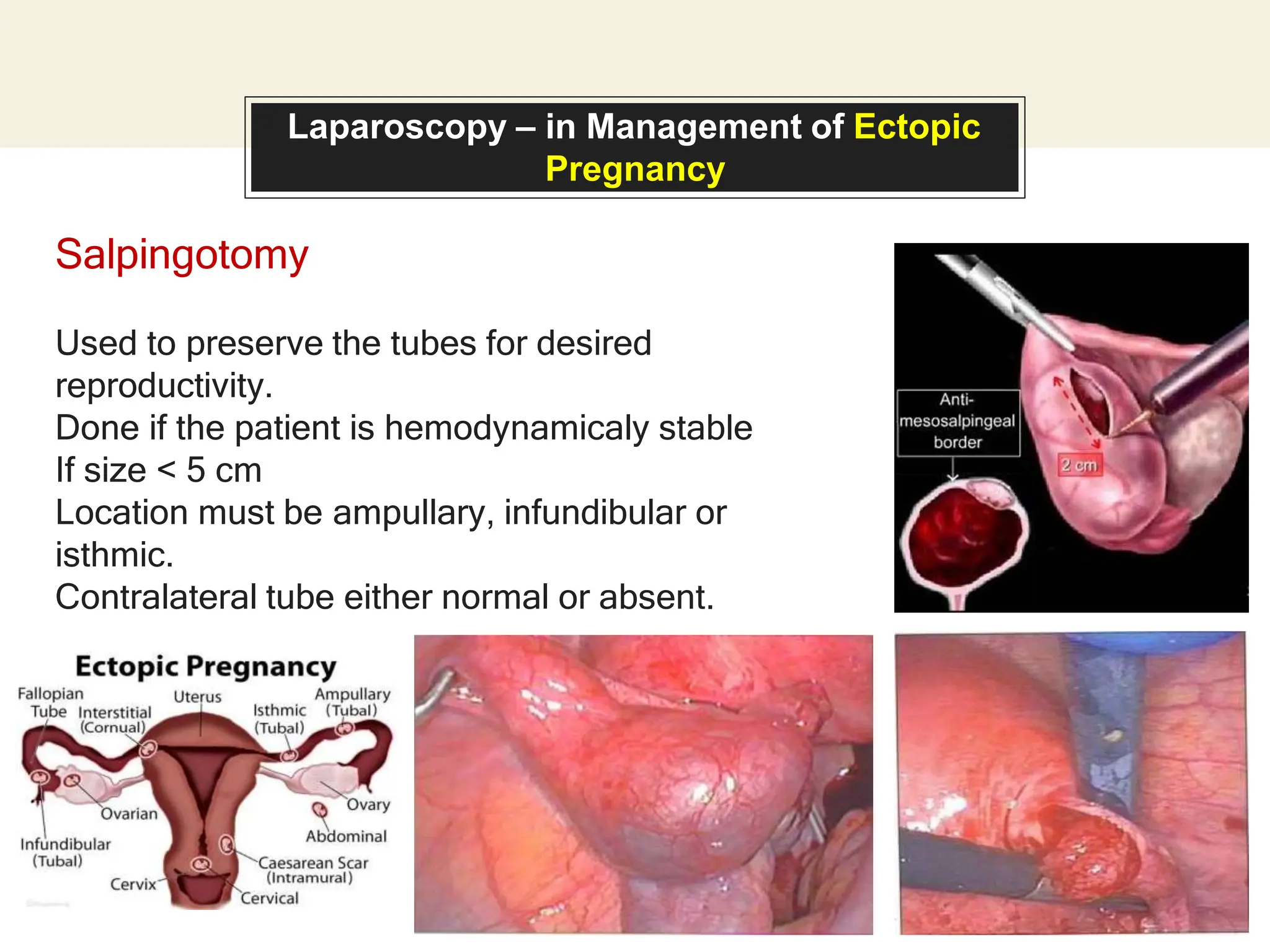 laparoscopy in gynaecology nursing students | PPTX