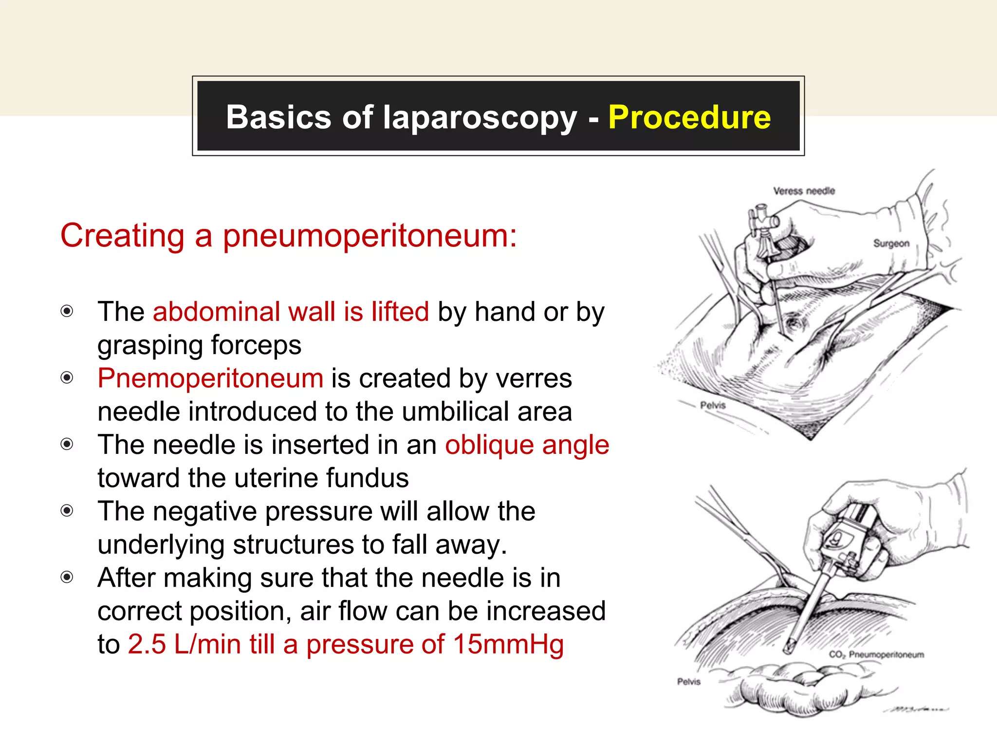 Laparoscopy in gynecology | PDF