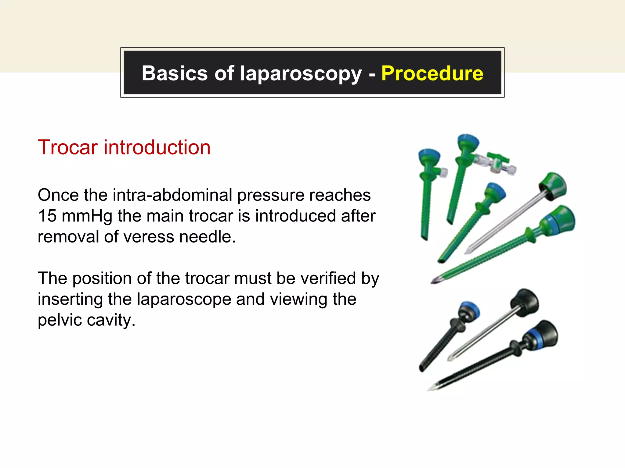 Laparoscopy in gynecology | PDF