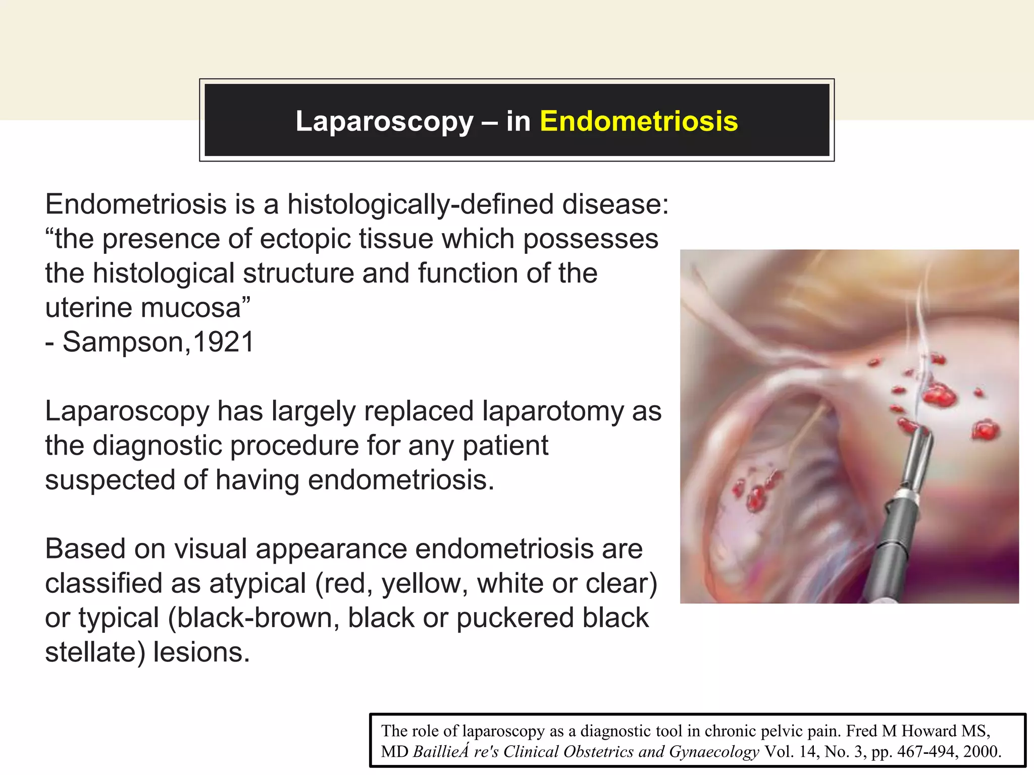 Laparoscopy in gynecology | PDF