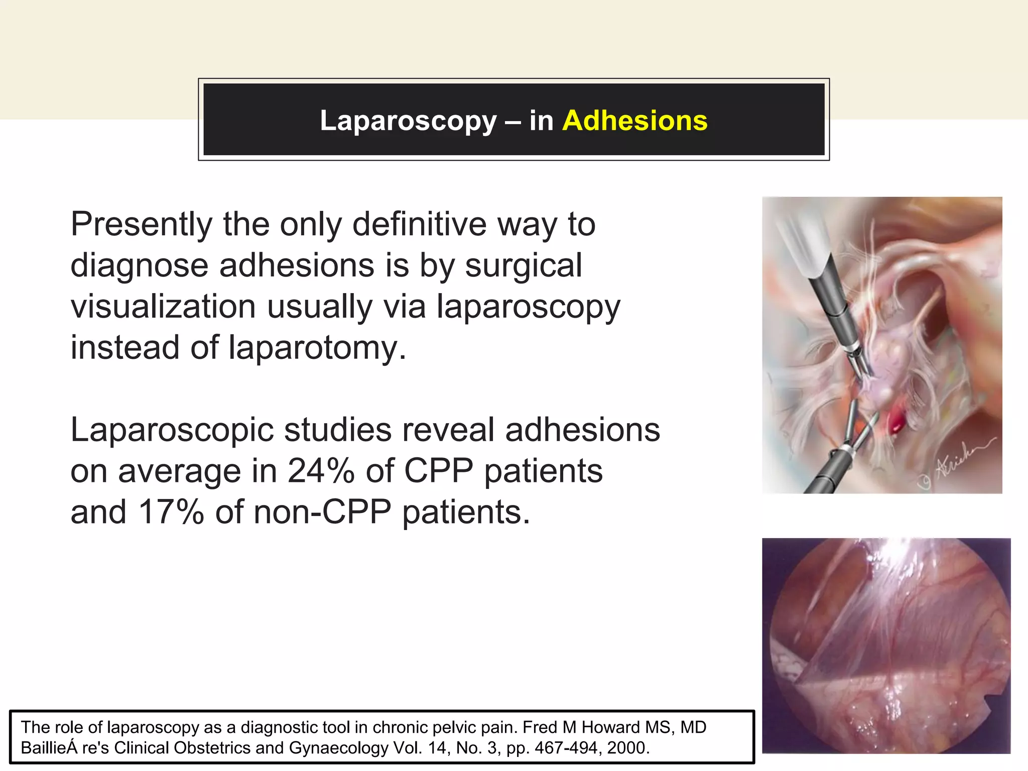 Laparoscopy in gynecology | PDF