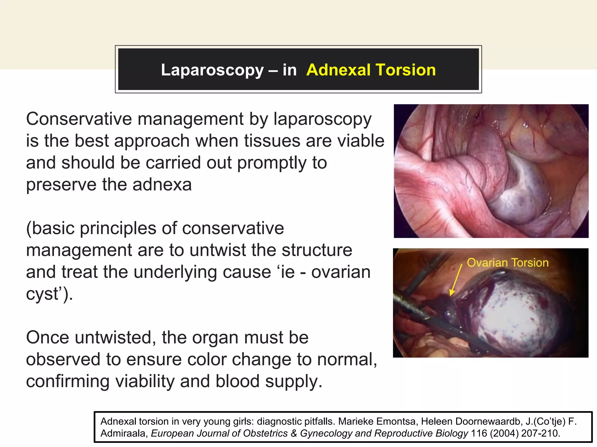 Laparoscopy in gynecology | PDF