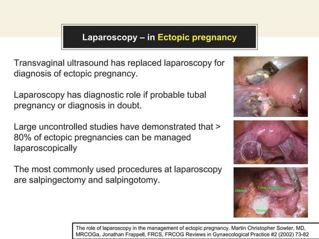 Laparoscopy in gynecology | PDF | Pregnancy | Reproductive Health