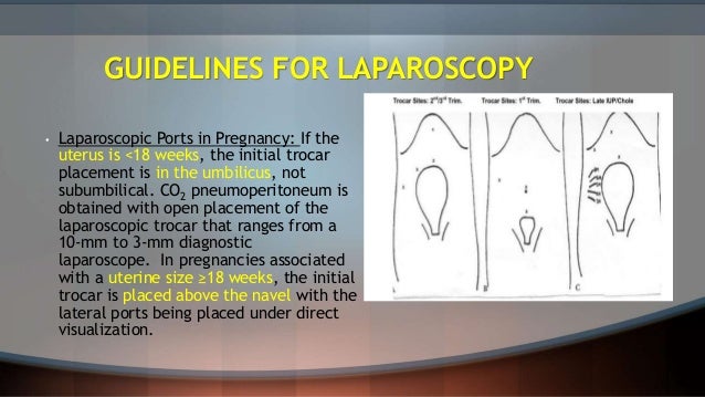 Laparoscopy in pregnancy