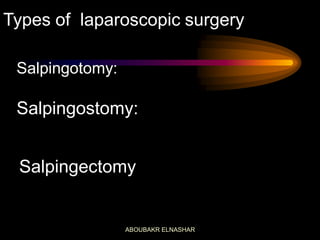 Laparoscopic management of tubal pregnancy | PDF | Pregnancy ...