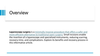 Laparoscopy Surgery - Benefits & Recovery Process.pdf