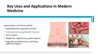 Laparoscopy Surgery - Benefits & Recovery Process.pdf