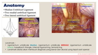 LAPAROSCOPY TAPP HERNIA inguinal ( tehnik operasi ) azis | PPTX