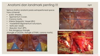 LAPAROSCOPY TAPP HERNIA inguinal ( tehnik operasi ) azis | PPTX