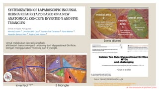 LAPAROSCOPY TAPP HERNIA inguinal ( tehnik operasi ) azis | PPTX