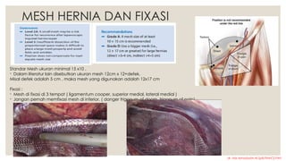 LAPAROSCOPY TAPP HERNIA inguinal ( tehnik operasi ) azis | PPTX